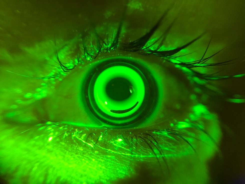 Vos questions sur les lentilles de nuit (FAQ)